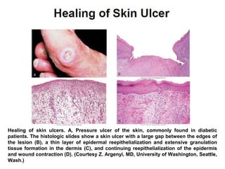 Tissue repair, regeneration and wound healing (1) | PPT