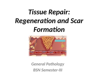Tissue_Repair_Regeneration_Scar_Formation_Presentation.pptx