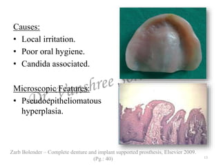 Tissue response to cd and preventing and treating the abused tissues | PPTX
