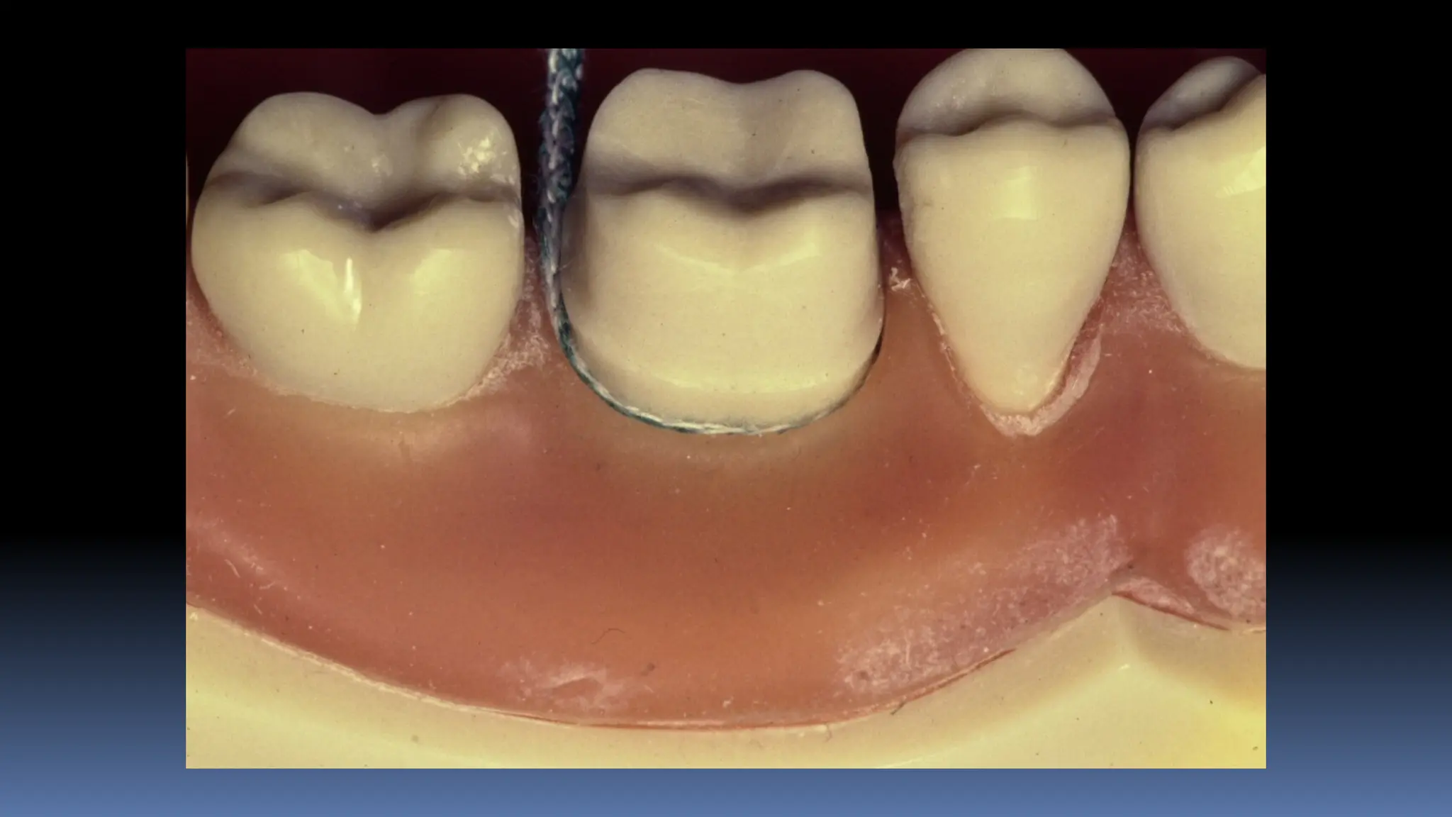soft tissue management and the soft tissue of interest.pptx