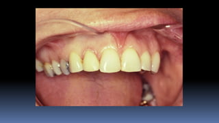 soft tissue management and the soft tissue of interest.pptx
