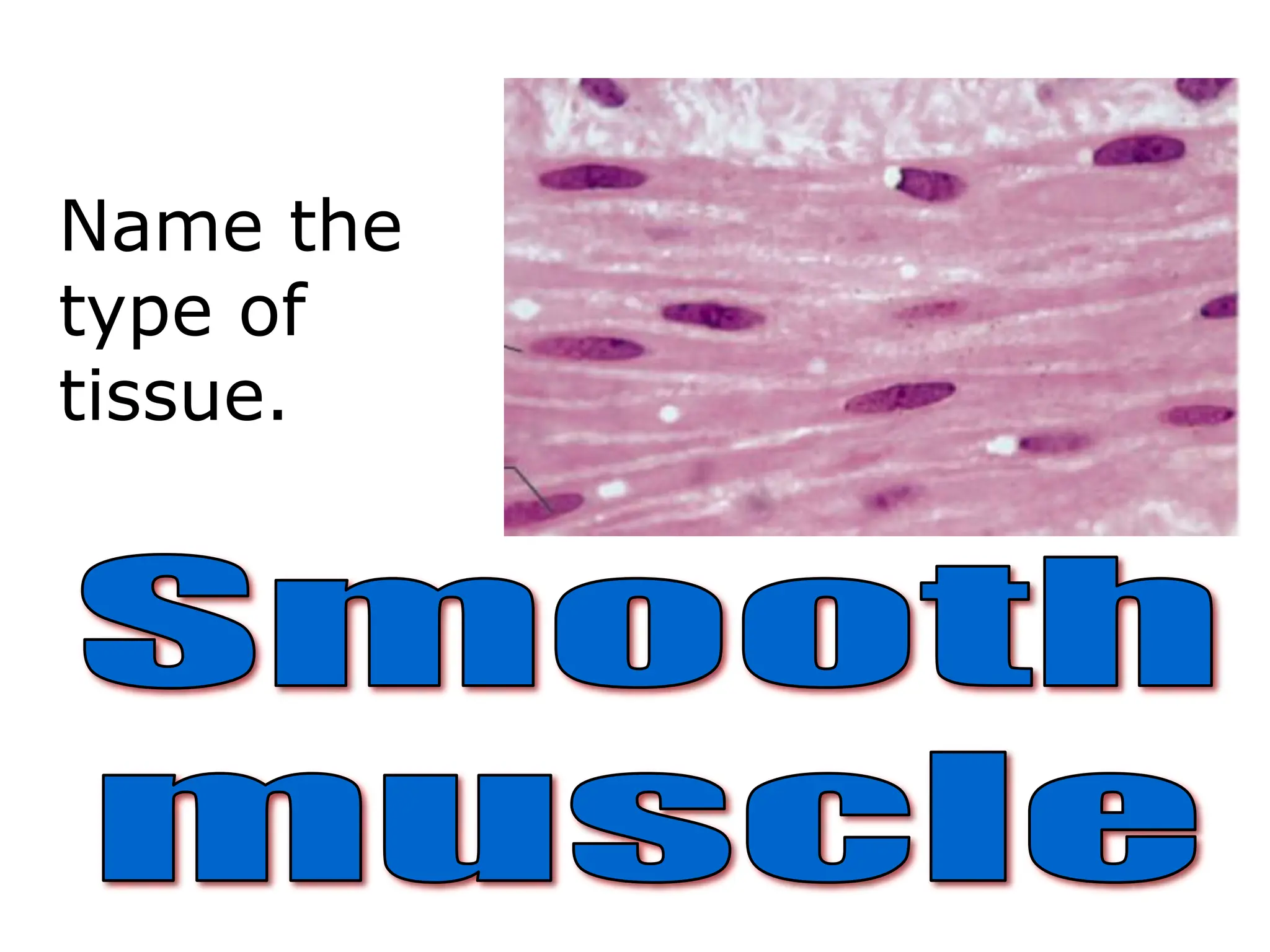 Four types of tissues: Epithelial tissue; Connective tissue; Muscle ...