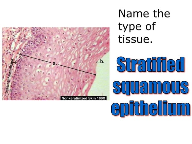 Four types of tissues: Epithelial tissue; Connective tissue; Muscle ...