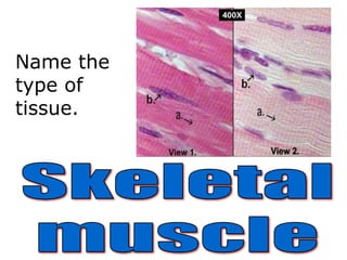 Four types of tissues: Epithelial tissue; Connective tissue; Muscle ...