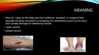 Tissues response to stress steps of wound healing | PPTX