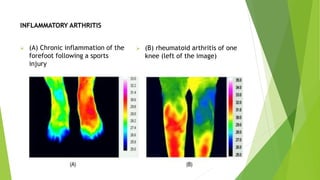 Thermal Imaging Technology | PPTX