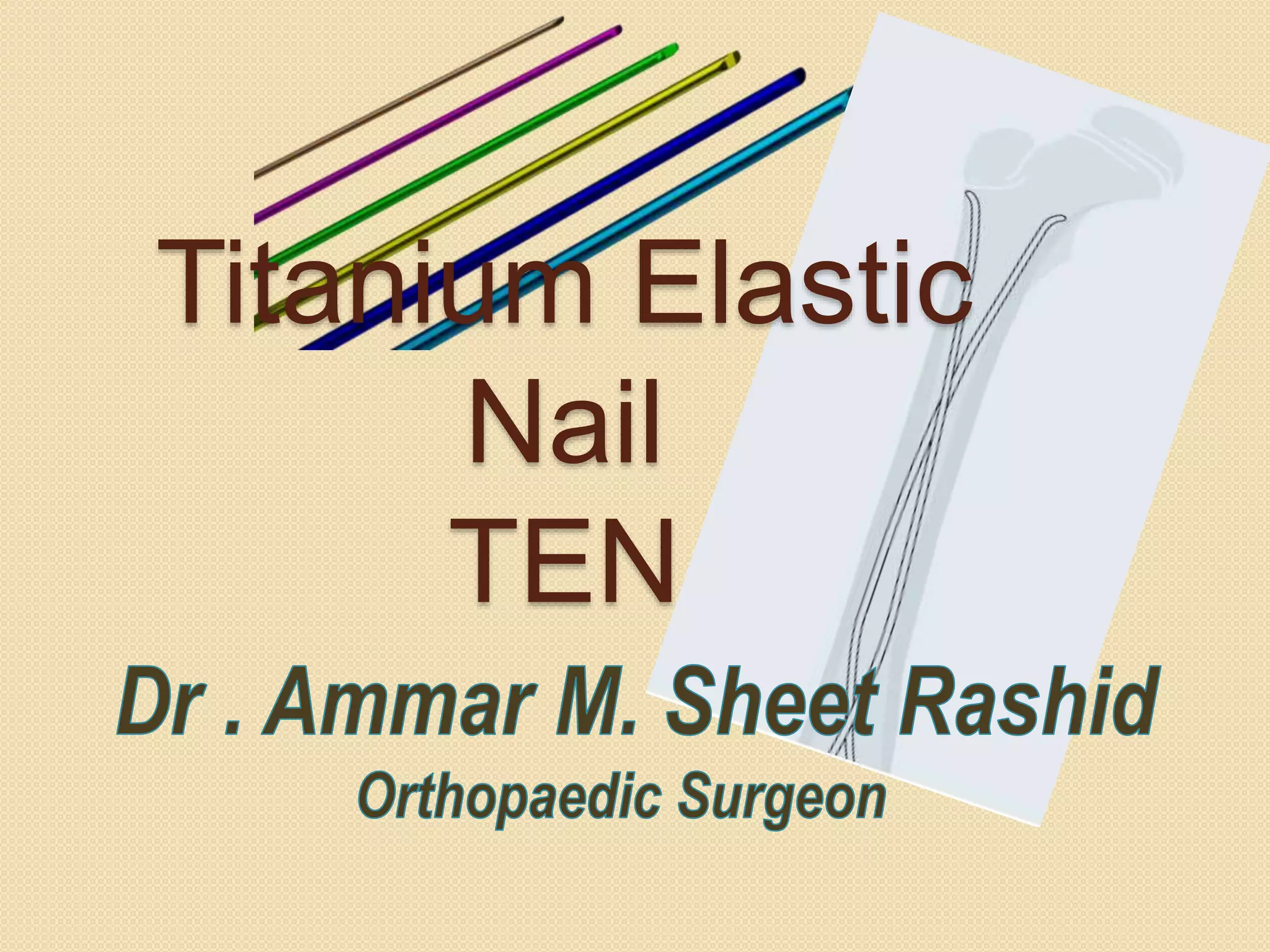 Titanium elastic nail | PPTX