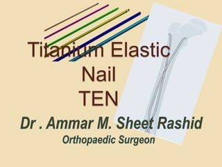 Titanium elastic nail | PPTX