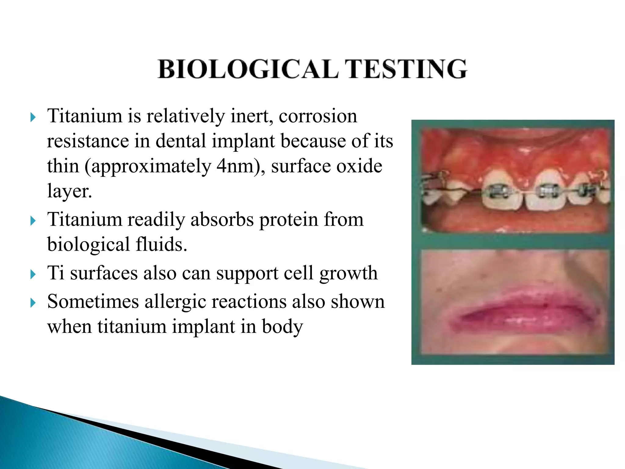 uses of Titanium in dentistry | PPTX