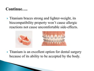 uses of Titanium in dentistry | PPTX