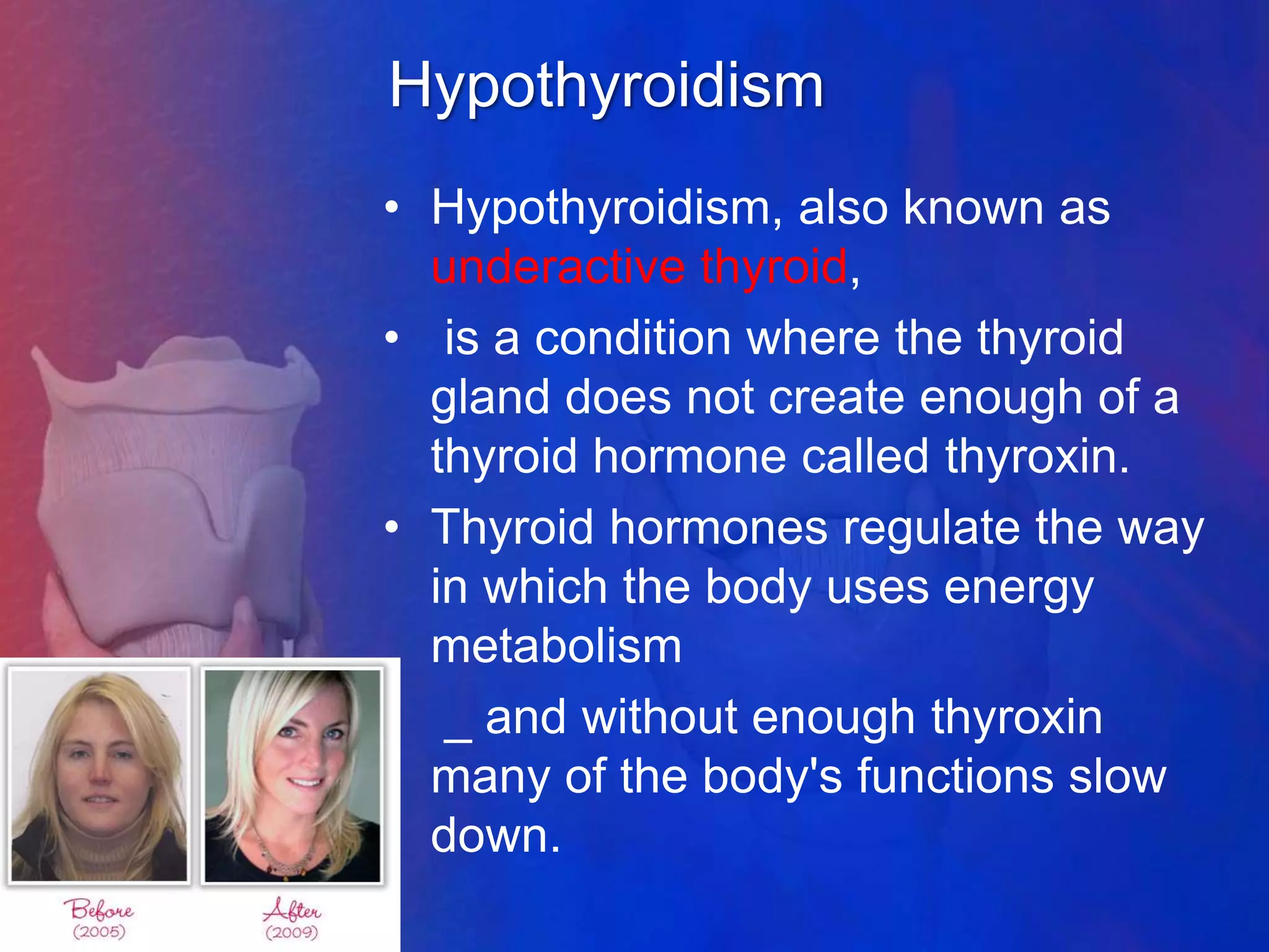 Title {thyroid gland} (1) | PPT