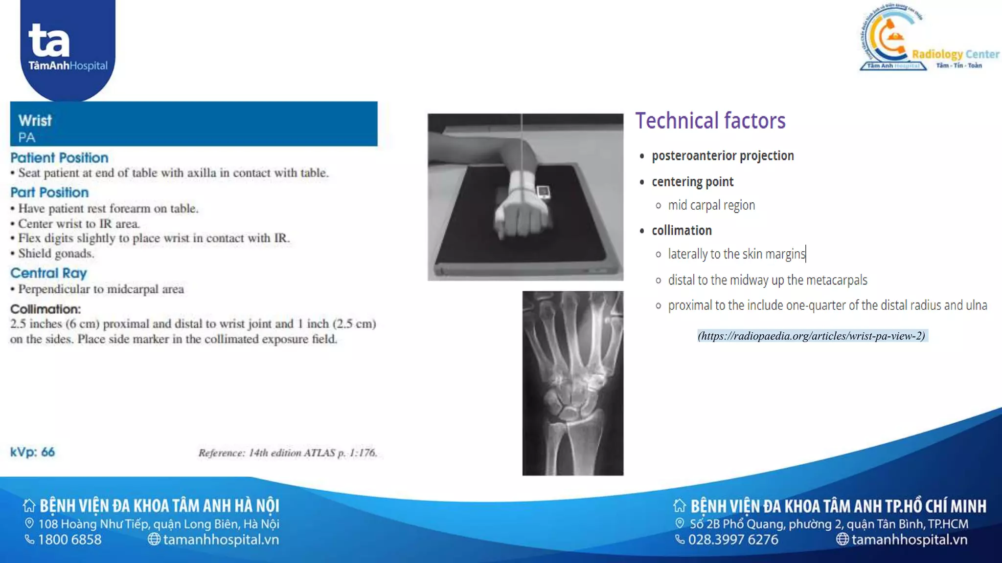 Tiêu chuẩn, kỹ thuật chụp XQuang cổ tay.pptx