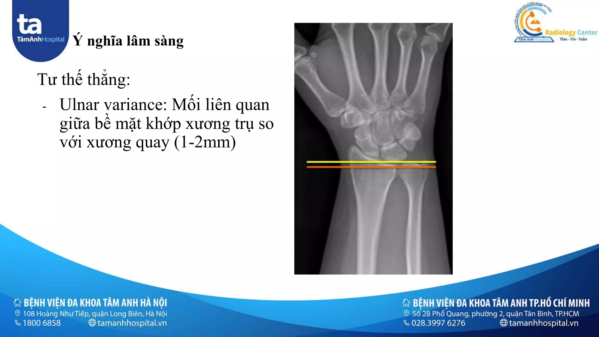 Tiêu chuẩn, kỹ thuật chụp XQuang cổ tay.pptx