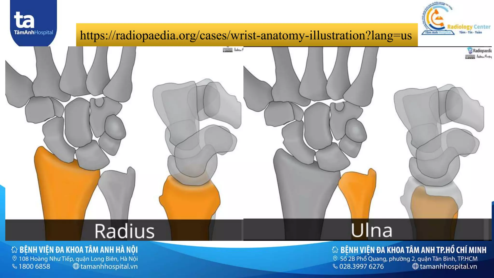 Tiêu chuẩn, kỹ thuật chụp XQuang cổ tay.pptx
