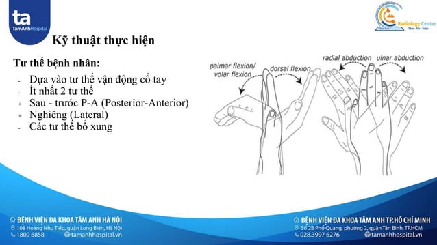 Tiêu chuẩn, kỹ thuật chụp XQuang cổ tay.pptx