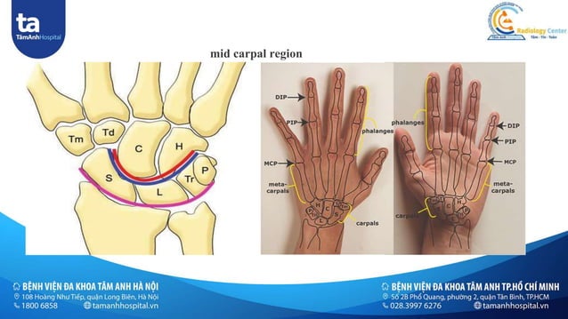 Tiêu chuẩn, kỹ thuật chụp XQuang cổ tay.pptx