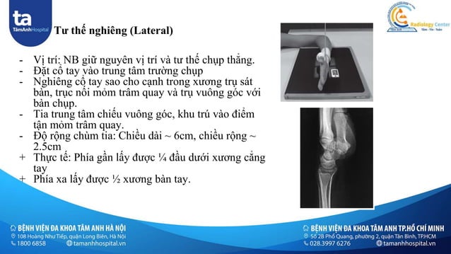 Tiêu chuẩn, kỹ thuật chụp XQuang cổ tay.pptx