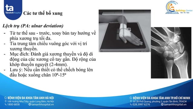Tiêu chuẩn, kỹ thuật chụp XQuang cổ tay.pptx