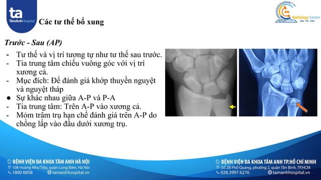 Tiêu chuẩn, kỹ thuật chụp XQuang cổ tay.pptx