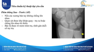 Tiêu chuẩn, kỹ thuật chụp XQuang cổ tay.pptx