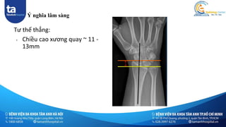 Tiêu chuẩn, kỹ thuật chụp XQuang cổ tay.pptx