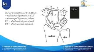 Tiêu chuẩn, kỹ thuật chụp XQuang cổ tay.pptx
