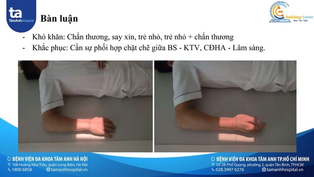Tiêu chuẩn, kỹ thuật chụp XQuang cổ tay.pptx
