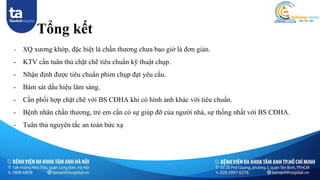 Tiêu chuẩn, kỹ thuật chụp XQuang cổ tay.pptx