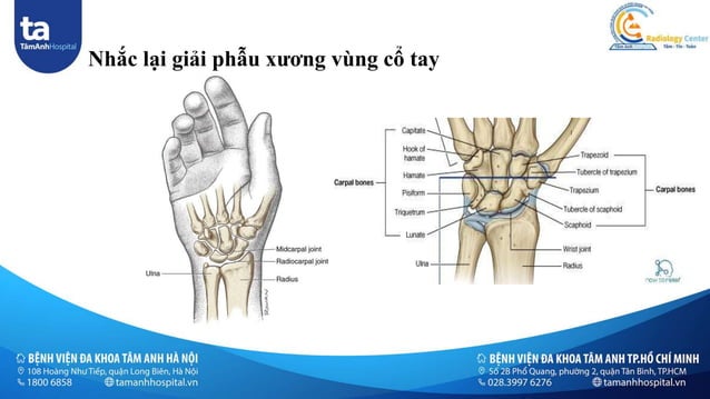 Tiêu chuẩn, kỹ thuật chụp XQuang cổ tay.pptx