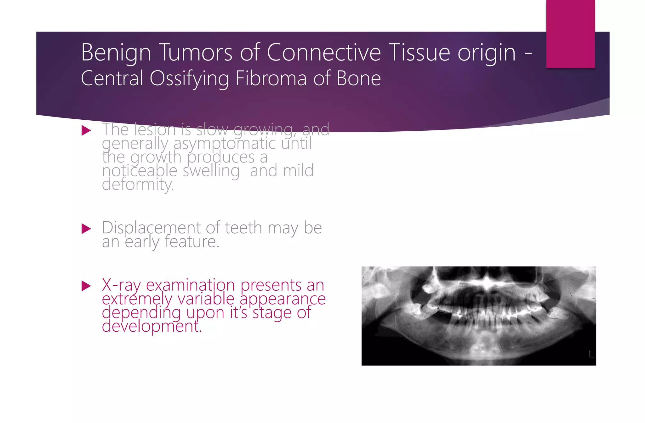 Benign tumors of oral cavity sonal | PPTX