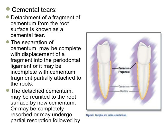 Cementum : An integral part of the Periodontium
