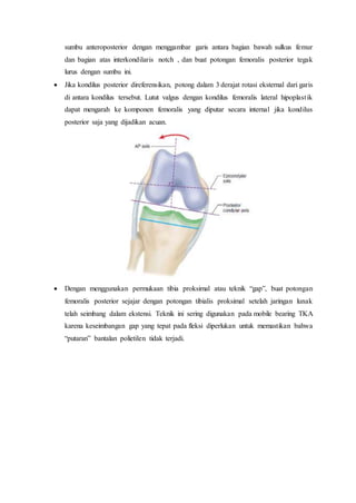Total knee replacement | DOCX