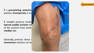 Mechanical principles of Total knee replacement arthroplasty | PPTX