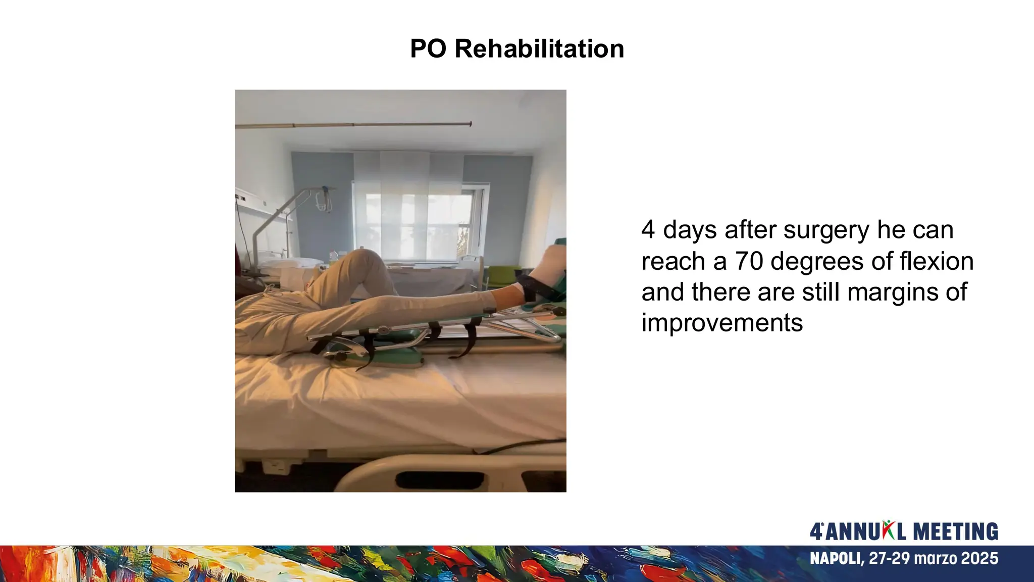 TKA in stiff knee - how to manage the right patient | PDF