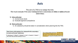 TKA in stiff knee - how to manage the right patient | PDF