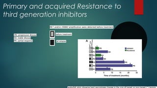 EGFR -TkI resistance pathways | ODP