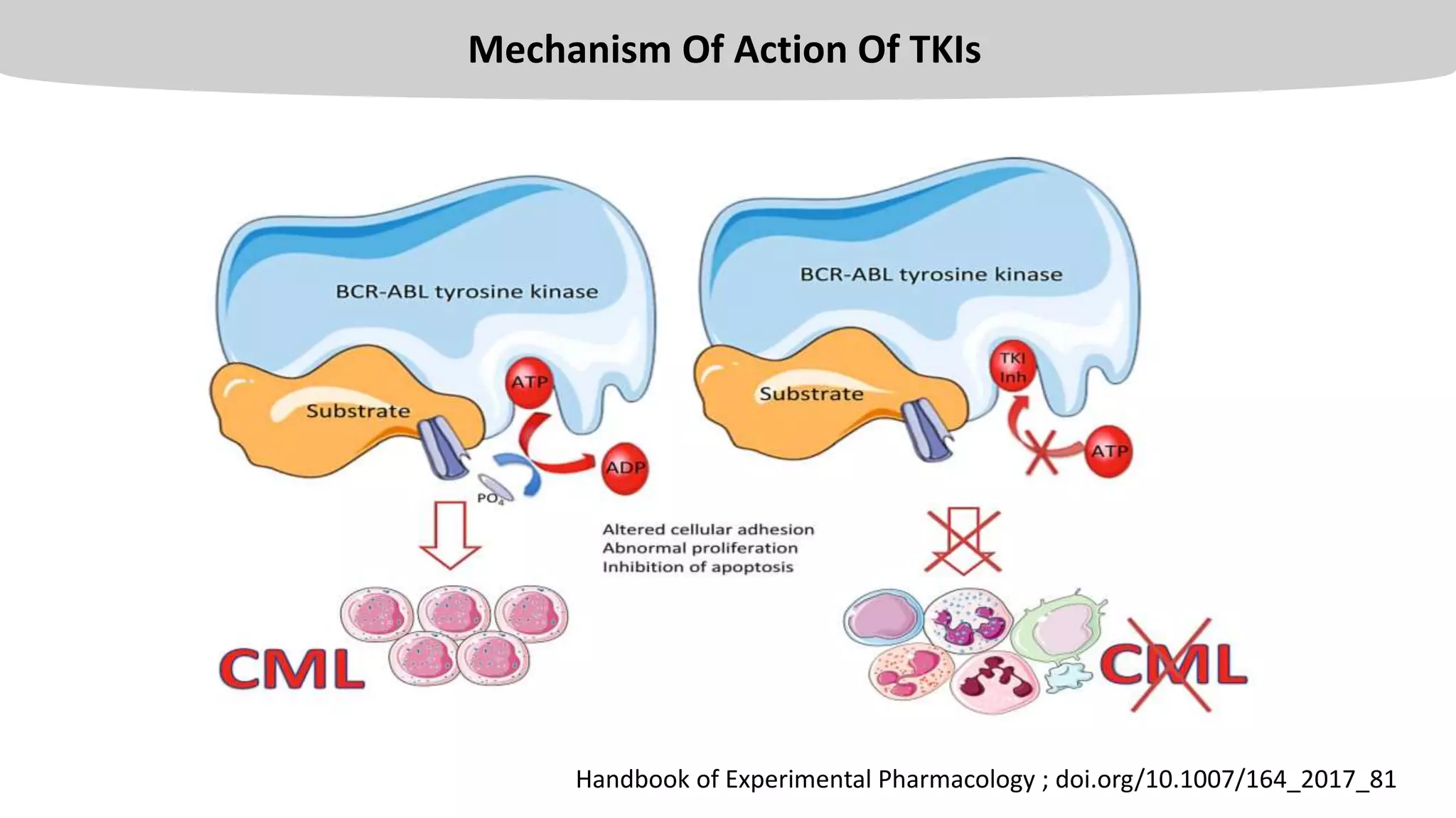 TKI Resistance Mechanisms in Chronic Myeloid Leukemia(CML) | PPTX