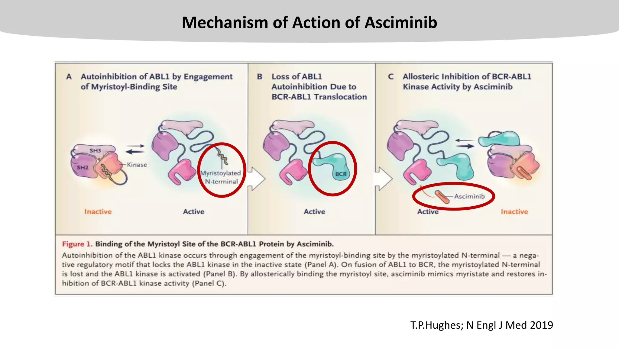TKI Resistance Mechanisms in Chronic Myeloid Leukemia(CML) | PPTX
