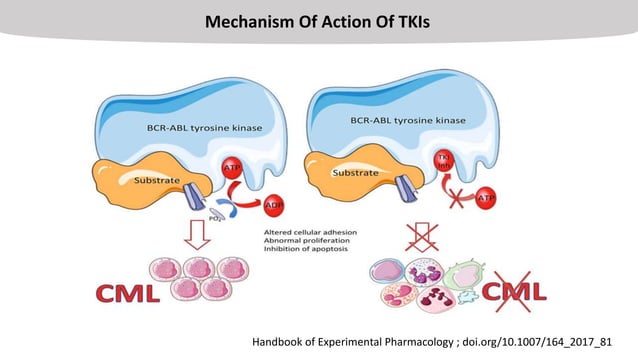 TKI Resistance Mechanisms in Chronic Myeloid Leukemia(CML) | PPTX