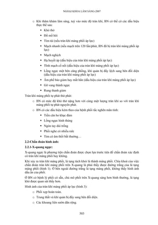 TKMP tự phát | PDF