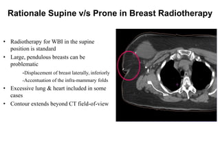 Immobilization and setup for Prone Breast Radiotherapy- A Therapist ...