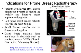 Immobilization and setup for Prone Breast Radiotherapy- A Therapist ...