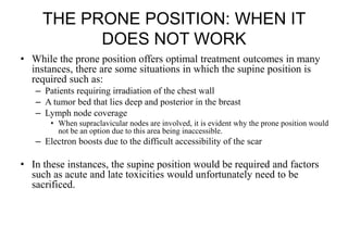 Immobilization and setup for Prone Breast Radiotherapy- A Therapist ...