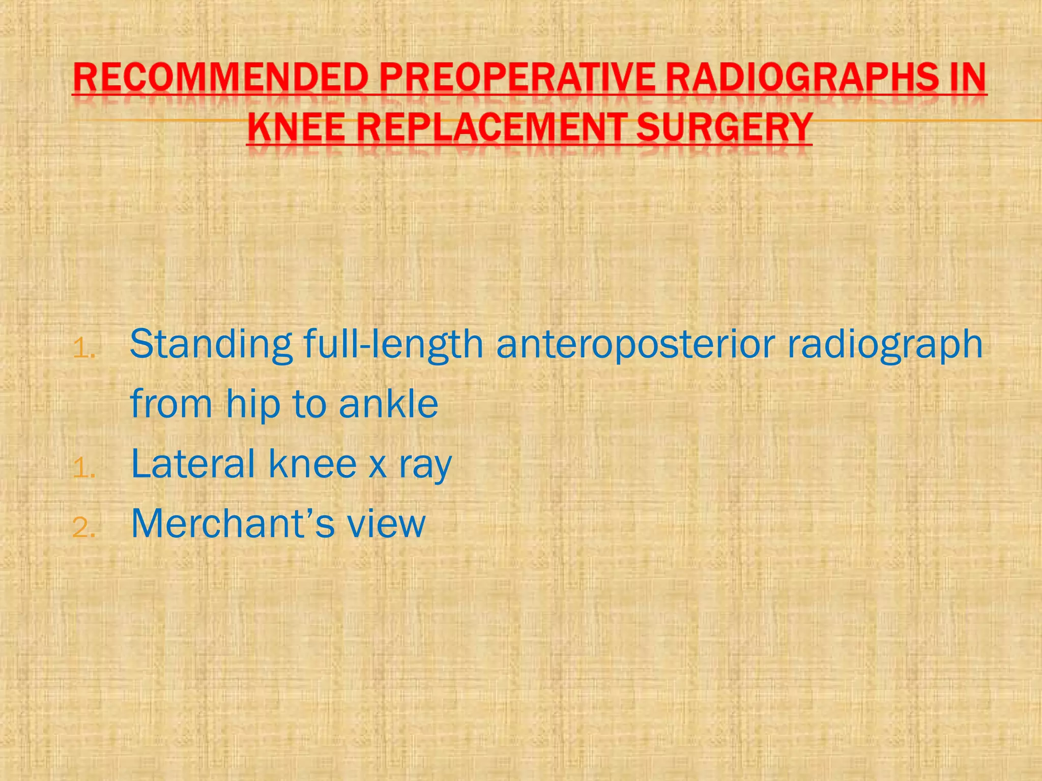 TOTAL KNEE REPLACEMENT | PPT
