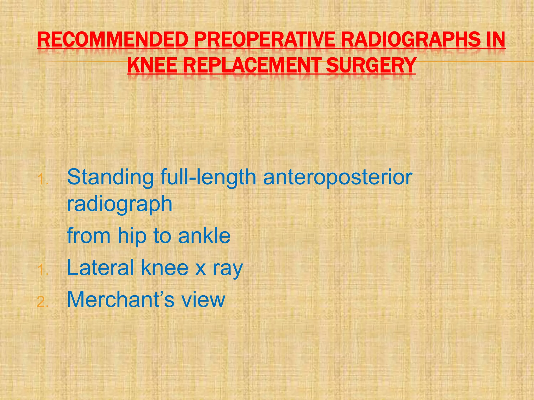 Total Knee Replacement (TKR) | PPT