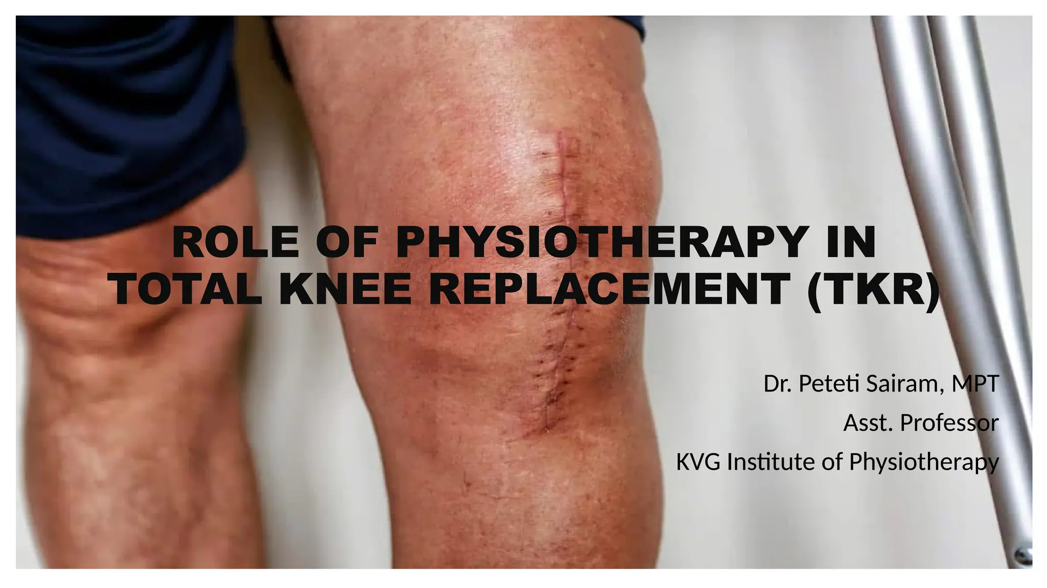 Role of physiotherapy in Total Knee Replacement.pptx