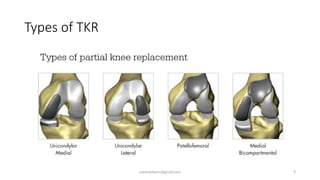Role of physiotherapy in Total Knee Replacement.pptx
