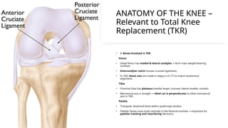 TKR for beginners total knee replacement.pptx