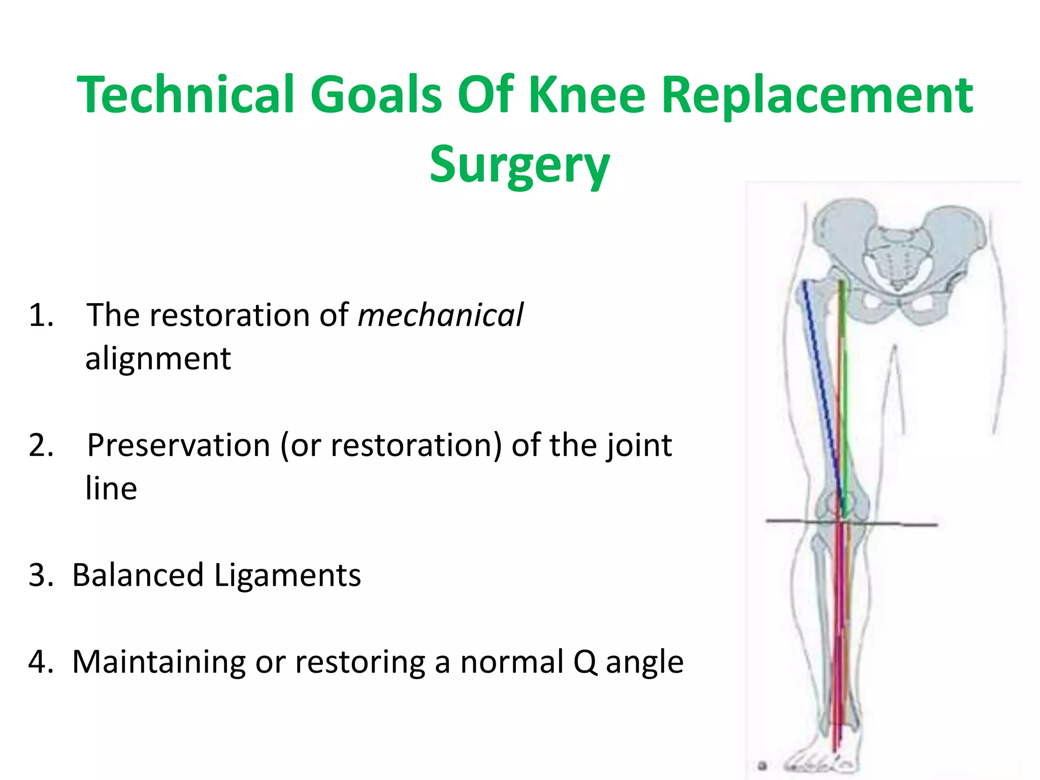 Tkr by dr. saumya agarwal | PPTX