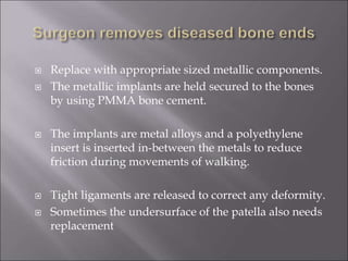 Total Knee Replacement (TKR) in advanced arthritis | PPT